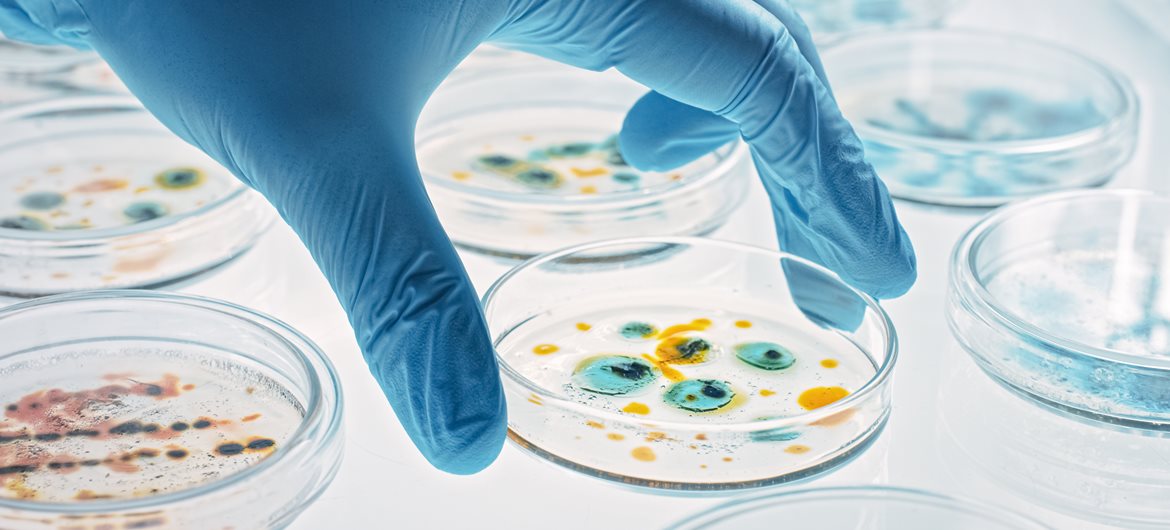 22 Strange and Gross Germ Facts | FactRetriever.com